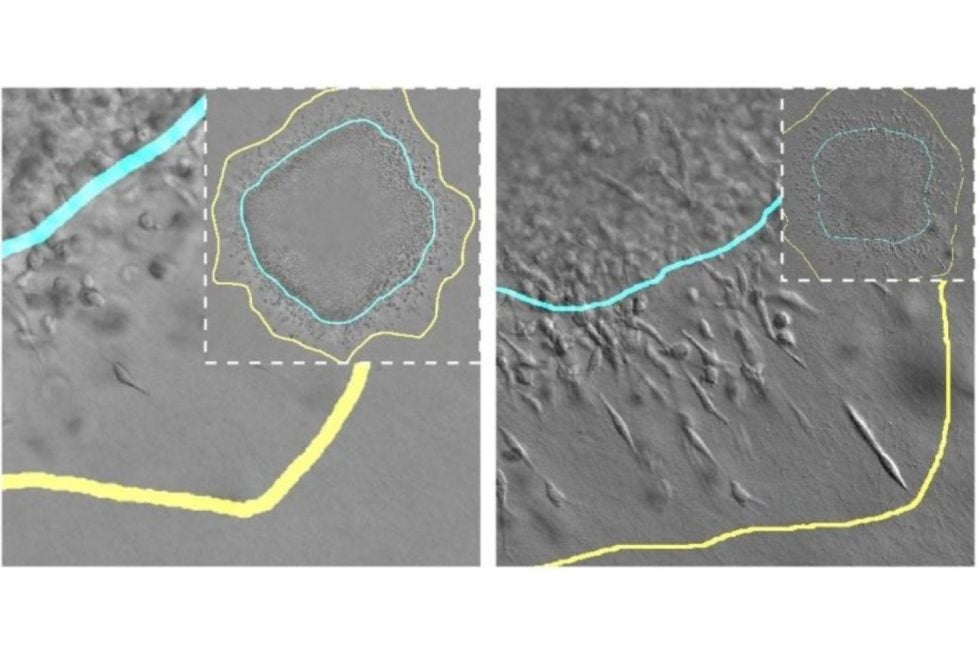 Uncovering the Biomechanics That Fuel or Stall Breast Cancer ...