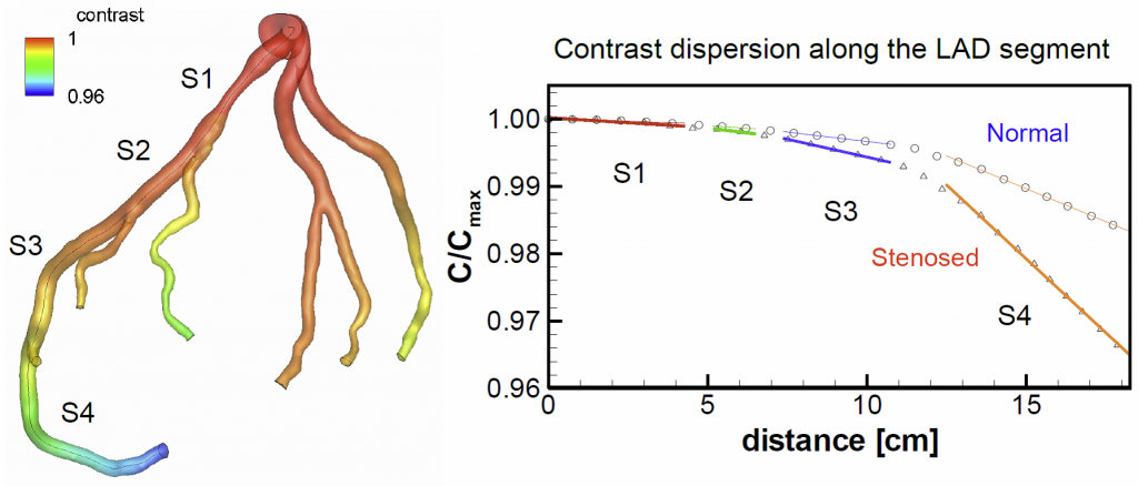 Vascular Flows - Flow Physics and Computation Lab