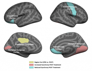 Welcome to the NSA Lab @ JHU - Neural Systems Analysis LaboratoryNeural ...