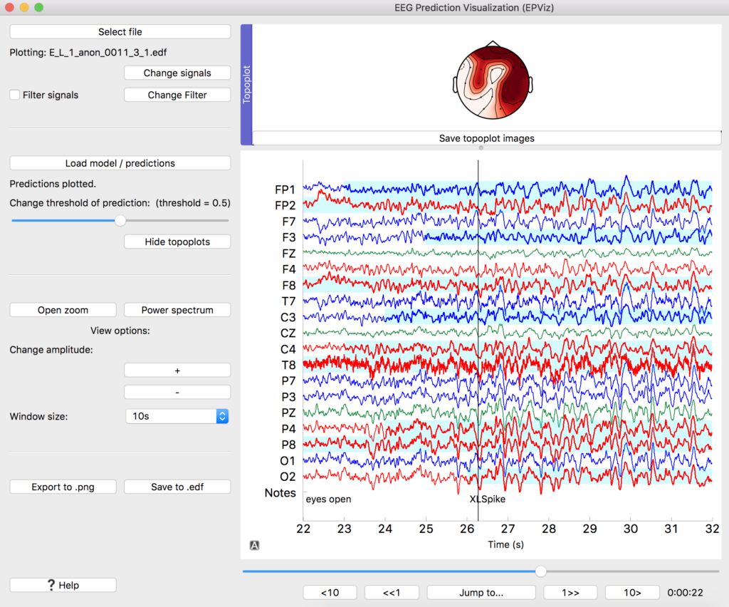 EPViz - Neural Systems Analysis LaboratoryNeural Systems Analysis ...