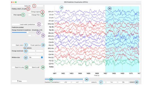 EPViz - Neural Systems Analysis LaboratoryNeural Systems Analysis ...
