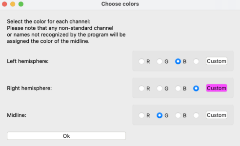 EPViz - Neural Systems Analysis LaboratoryNeural Systems Analysis ...