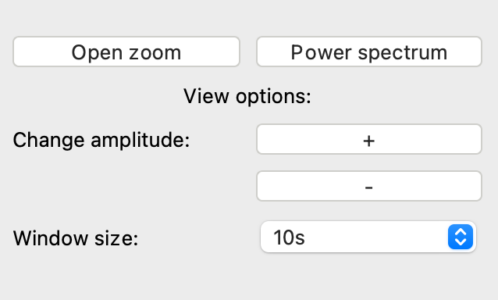EPViz - Neural Systems Analysis LaboratoryNeural Systems Analysis ...