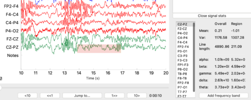 EPViz - Neural Systems Analysis LaboratoryNeural Systems Analysis ...