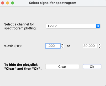 EPViz - Neural Systems Analysis LaboratoryNeural Systems Analysis ...