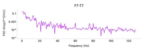 EPViz - Neural Systems Analysis LaboratoryNeural Systems Analysis ...