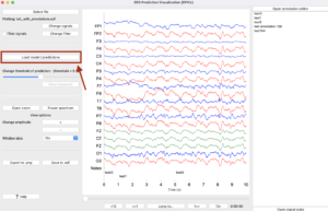 EPViz - Neural Systems Analysis LaboratoryNeural Systems Analysis ...