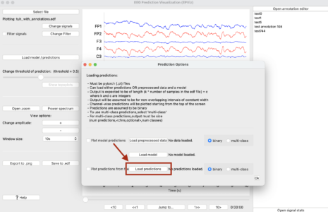EPViz - Neural Systems Analysis LaboratoryNeural Systems Analysis ...