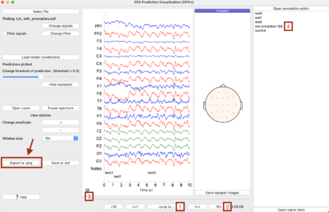 EPViz - Neural Systems Analysis LaboratoryNeural Systems Analysis ...