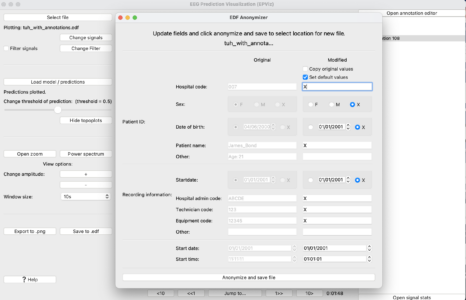 EPViz - Neural Systems Analysis LaboratoryNeural Systems Analysis ...