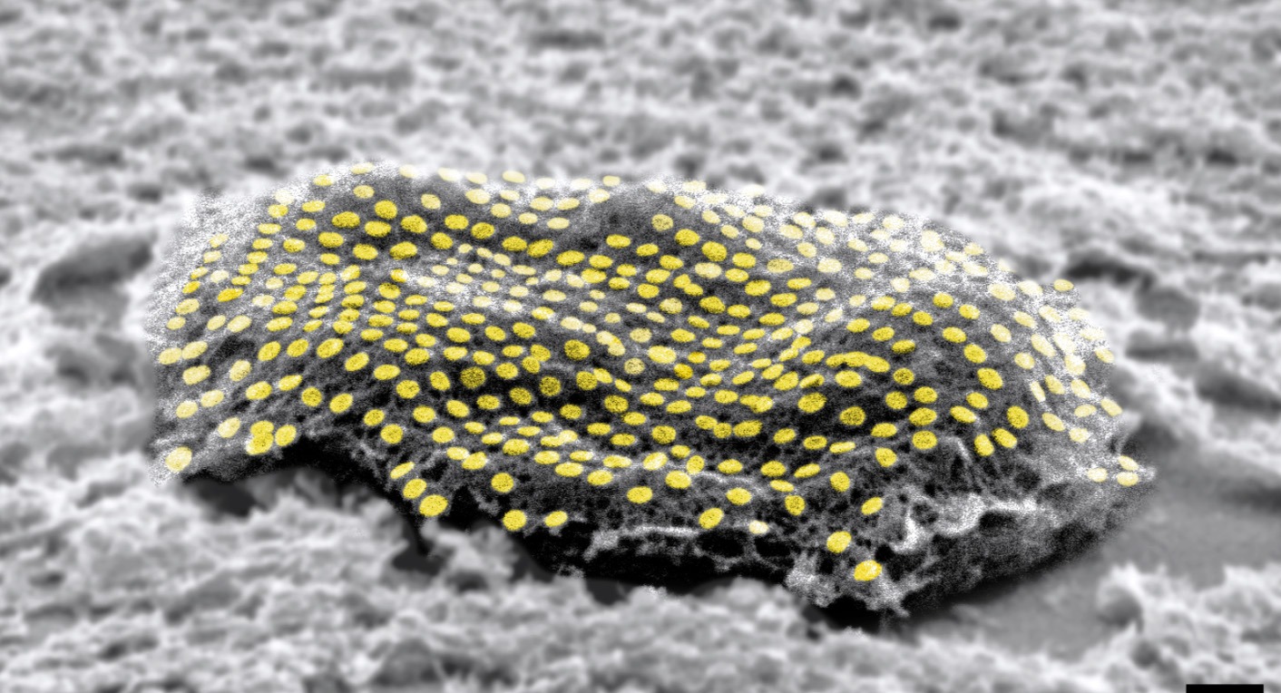 Latest in Body Art? "Tattoos" for Individual Cells - Johns Hopkins ...