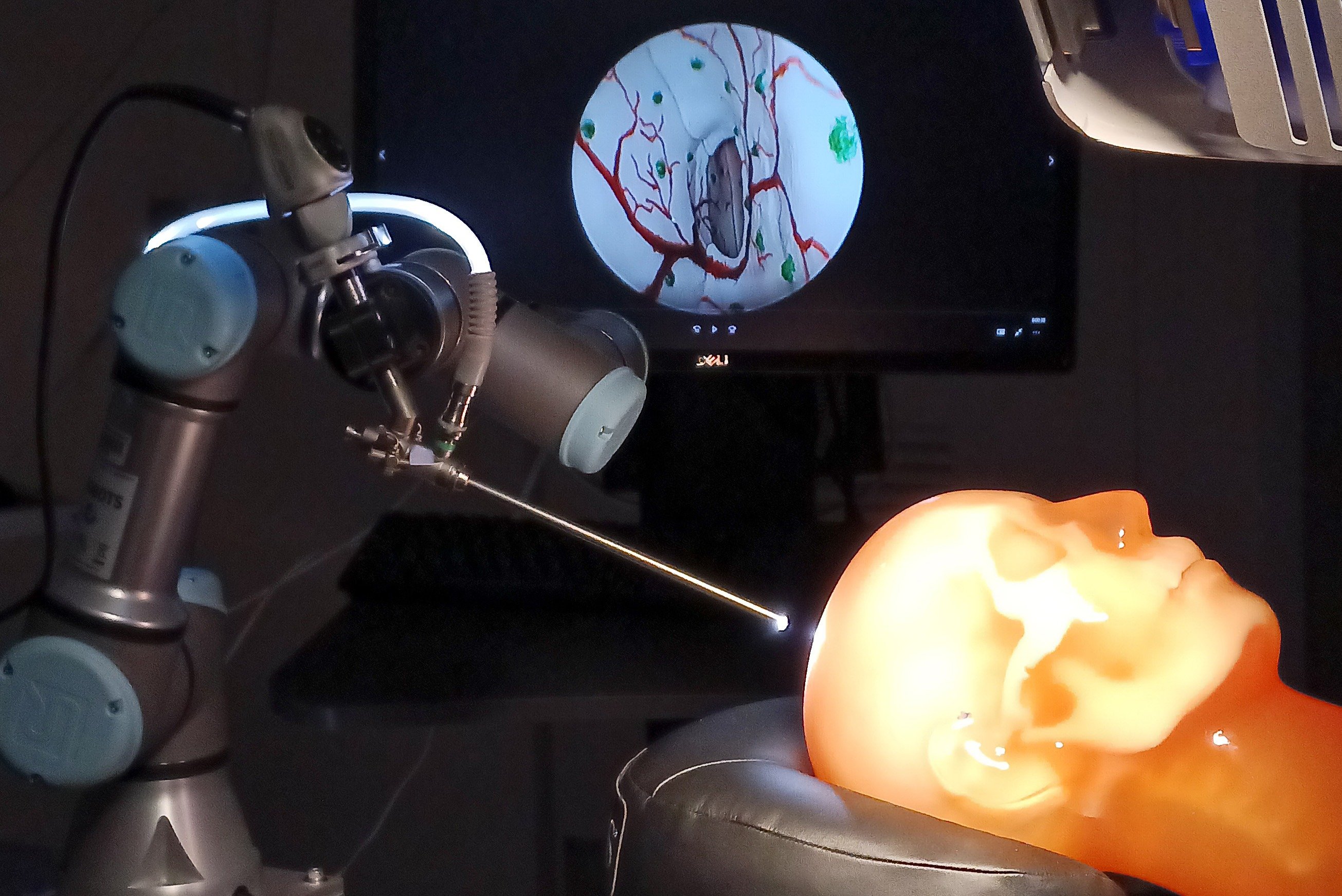 Navigation Technology Used in Self-Driving Cars Aids Brain Surgery ...