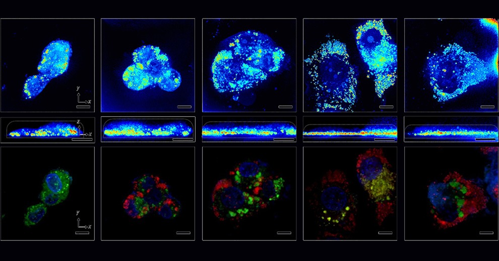 New Microscopy Method Detects Treatment-Resistant Cancer Cells Early ...