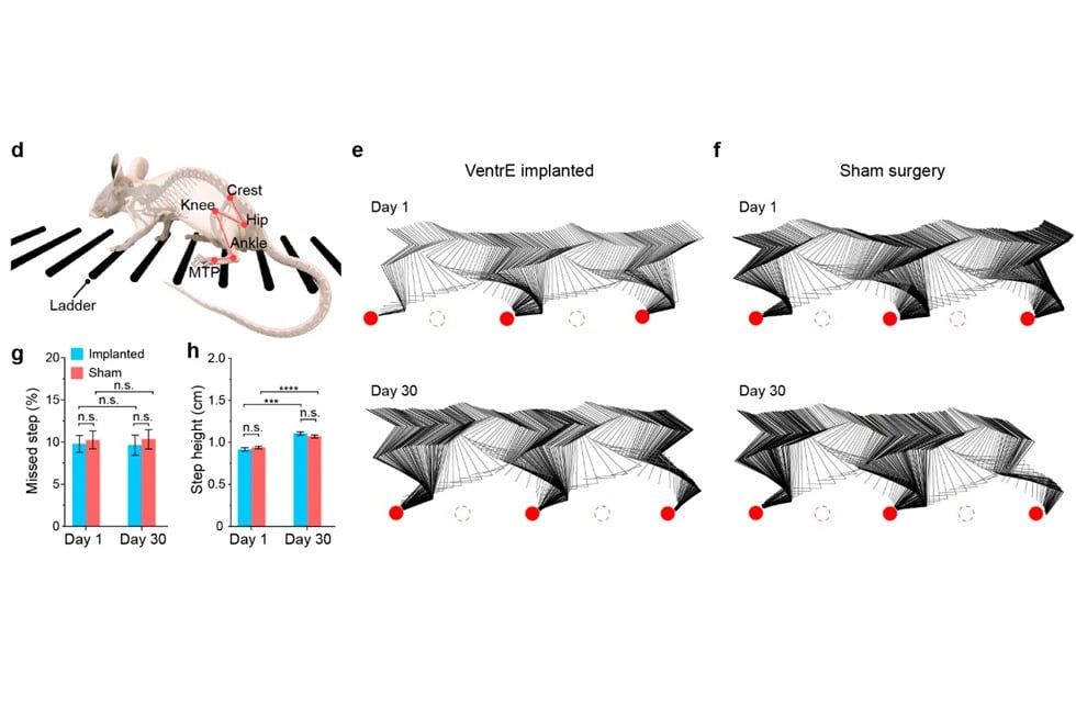 This Tiny Spinal Stimulator Could Someday Have a Big Impact on Lower ...