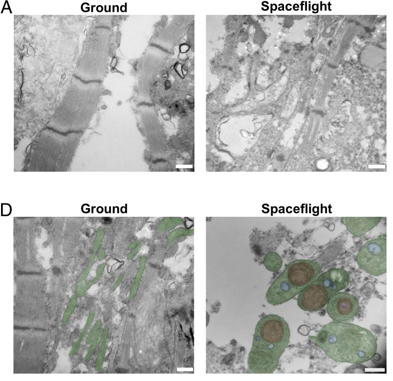 Low Gravity in Space Travel Found to Weaken and Disrupt Normal Rhythm ...