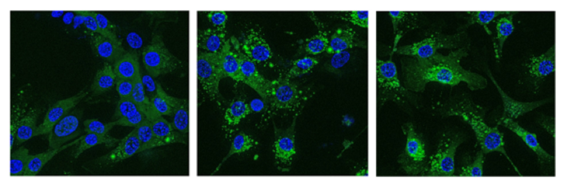 Goldilocks' Breakthrough in Gene Therapy Development - Johns Hopkins ...