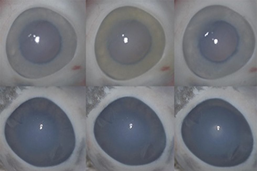 Scientists Engineer 'Glowing' Gel To Improve Eye Surgery - Johns ...