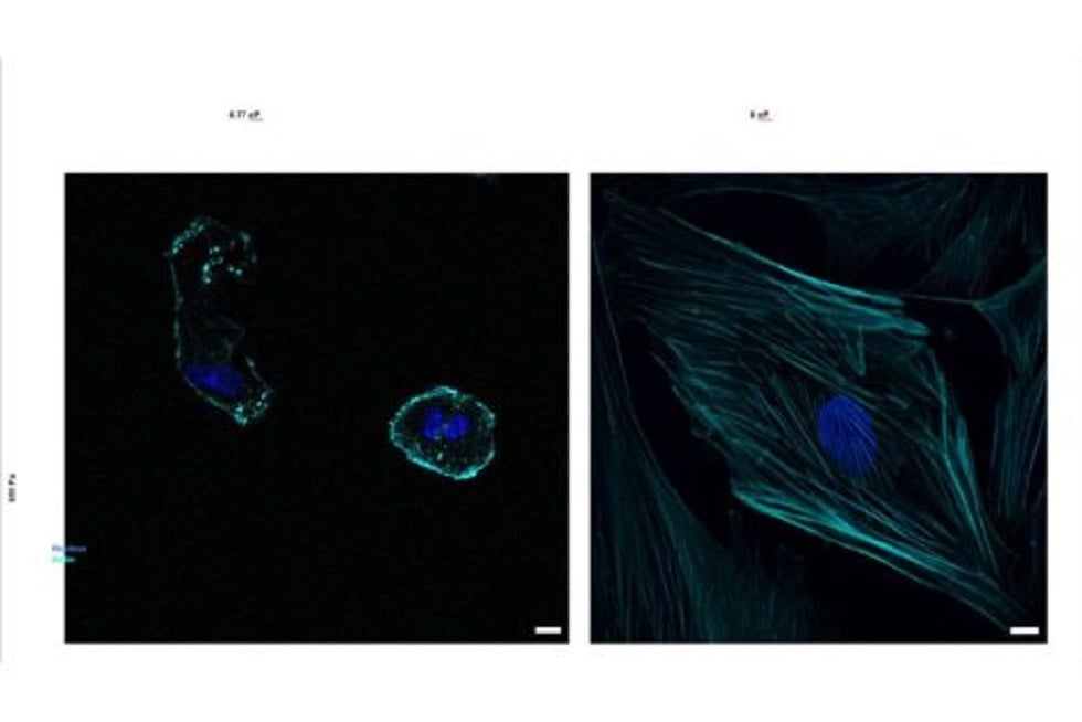 Sticky Science: How Thicker Fluids Turn Stem Cells Toward New Roles ...
